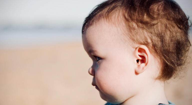 Baby Head Shapes: Causes and Concerns - The HyperHive
