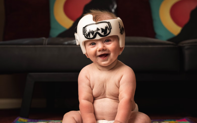 Baby Head Shapes: Causes and Concerns - The HyperHive