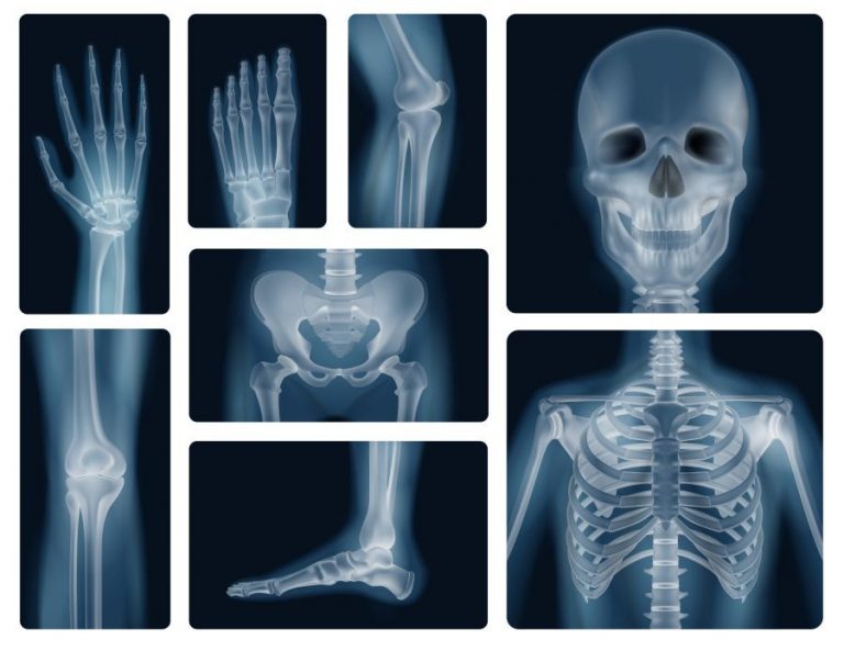The Never Broken a Bone Theory: What It Means for You - The HyperHive